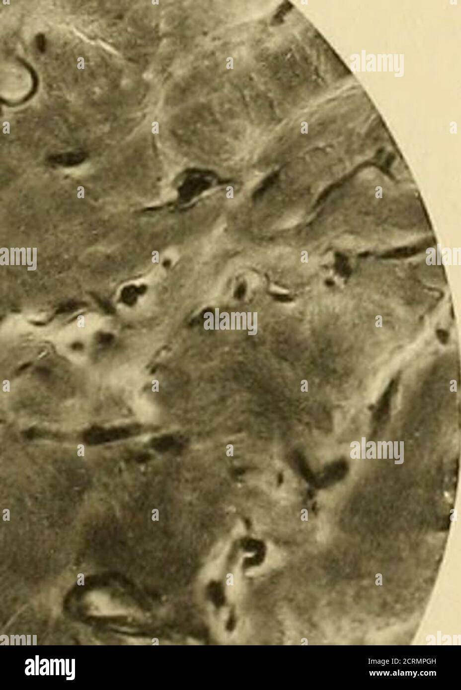 Wolbach hi-res stock photography and images - Alamy