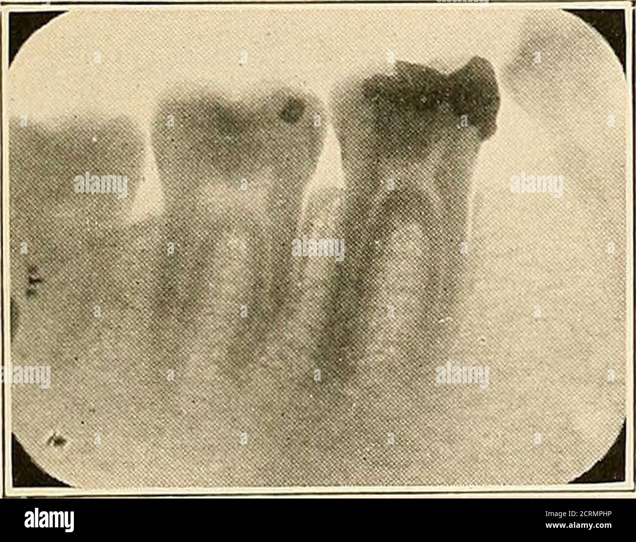 . Oral sepsis in its relationship to systemic disease . lusion ...