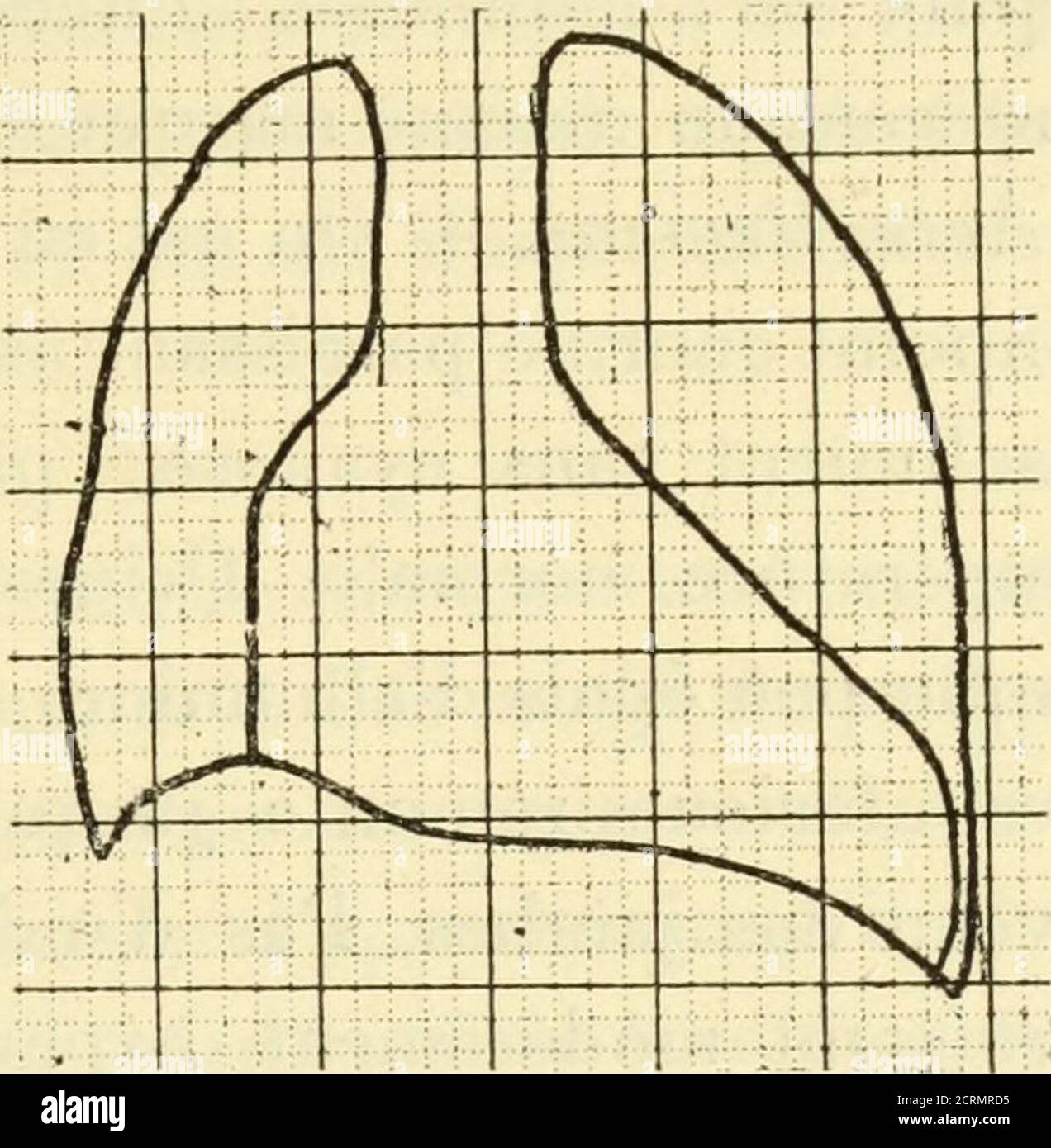 Diagnostic cardiaque hi-res stock photography and images - Alamy