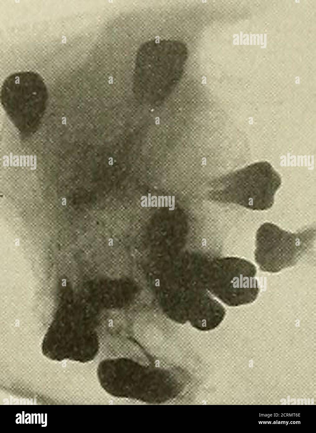 . Radiography and radio-therapeutics . ^Nsy Stock Photo - Alamy