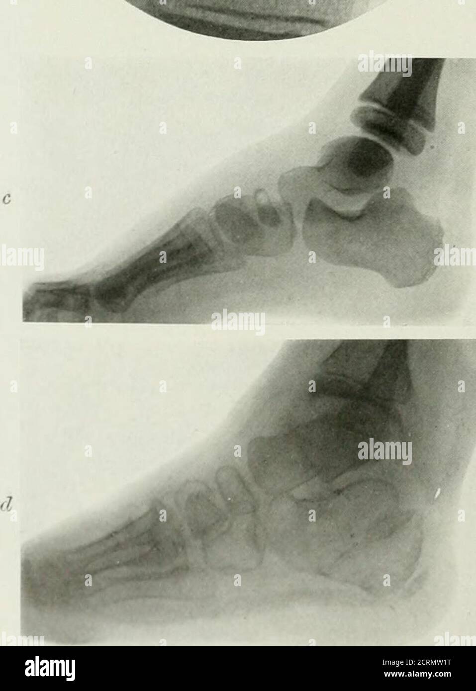 . Radiography and radio-therapeutics . *^-*w*lt Stock Photo - Alamy