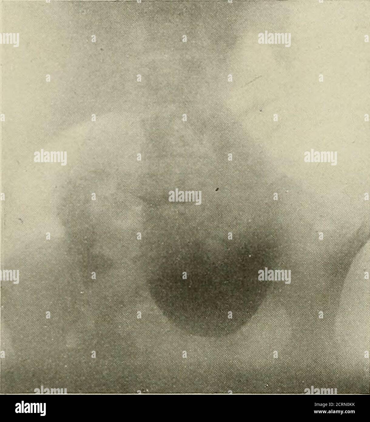 Emptying plate hi-res stock photography and images - Alamy