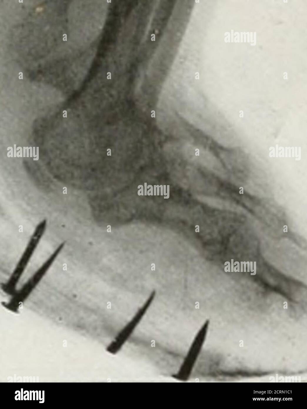 . The American journal of roentgenology, radium therapy and nuclear ...