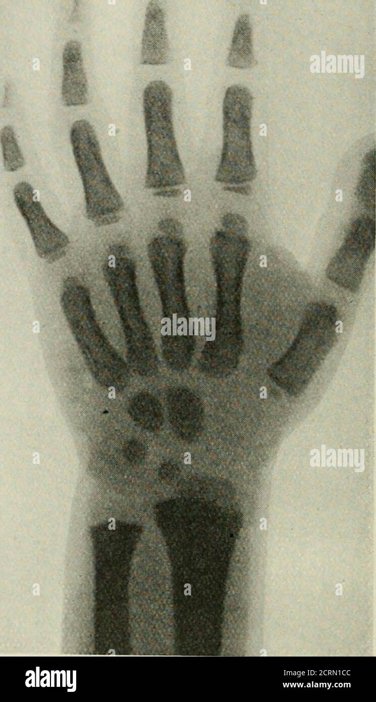 . Radiography and radio-therapeutics . J ^Appear^ 4-5-)fr J Unites l ...