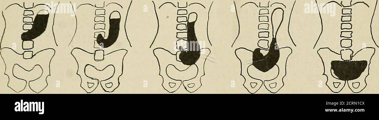 . Radiography and radio-therapeutics . 24 hours PLATE LXIV.—Hour-glass ...