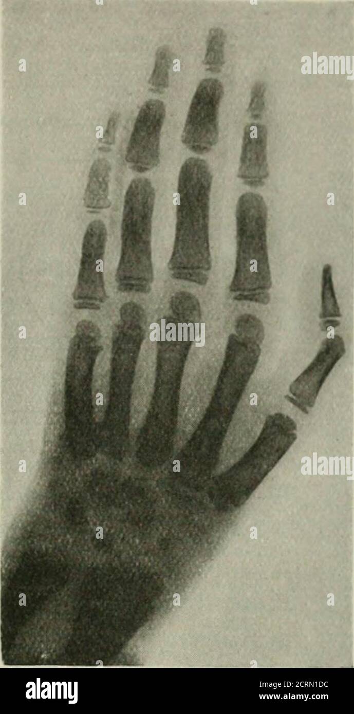 Ossification centre hi-res stock photography and images - Alamy