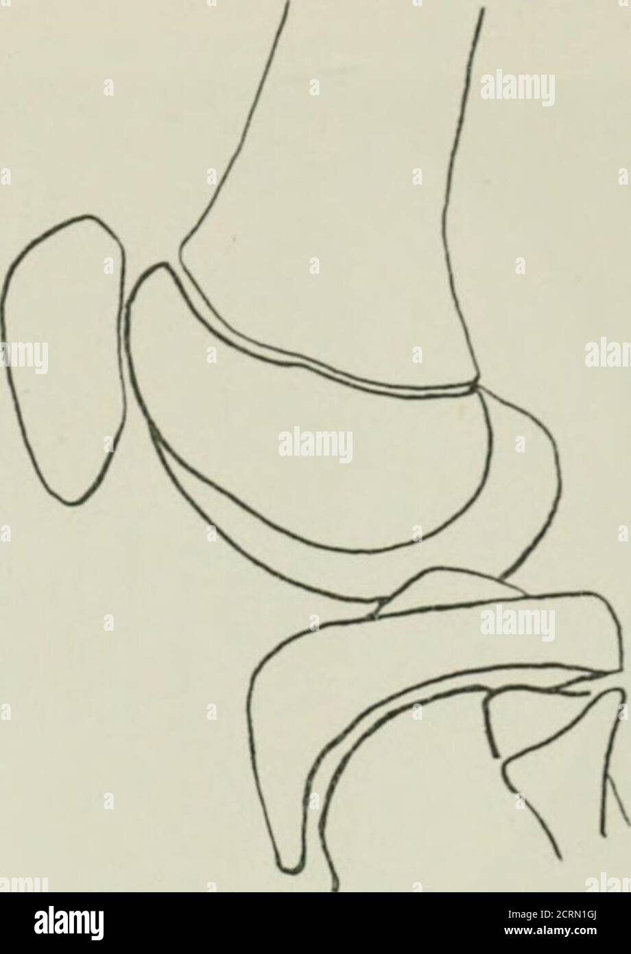 . Radiography and radio-therapeutics . Epiphyseal line Patella Aiitero ...