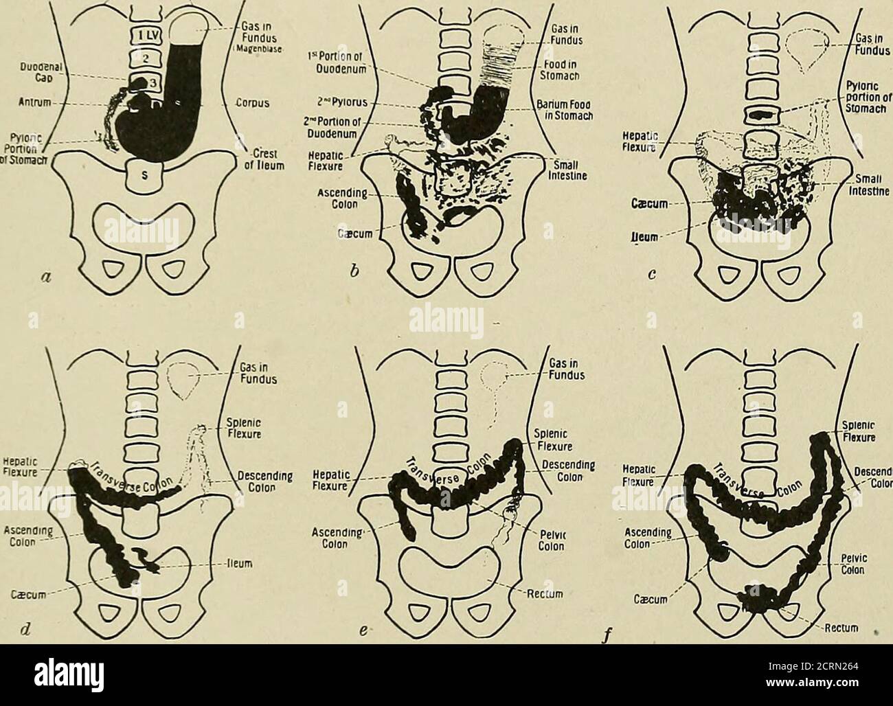 . Radiography and radio-therapeutics . ng colon visible. (/) 7 p.m. Ten ...