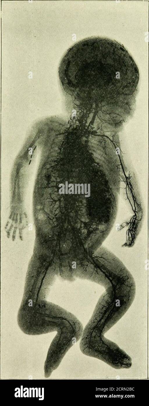 Electro static discharge hi-res stock photography and images - Alamy