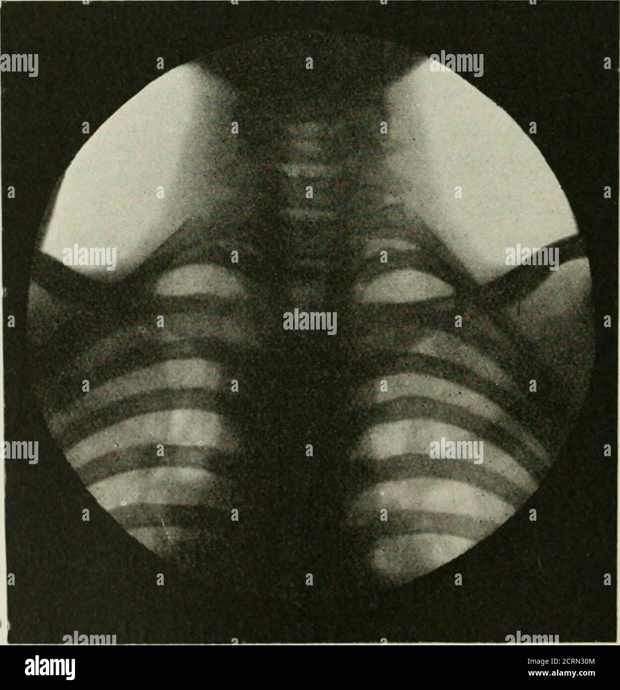 . Radiography and radio-therapeutics . Fig 183.—Normal cervical and ...