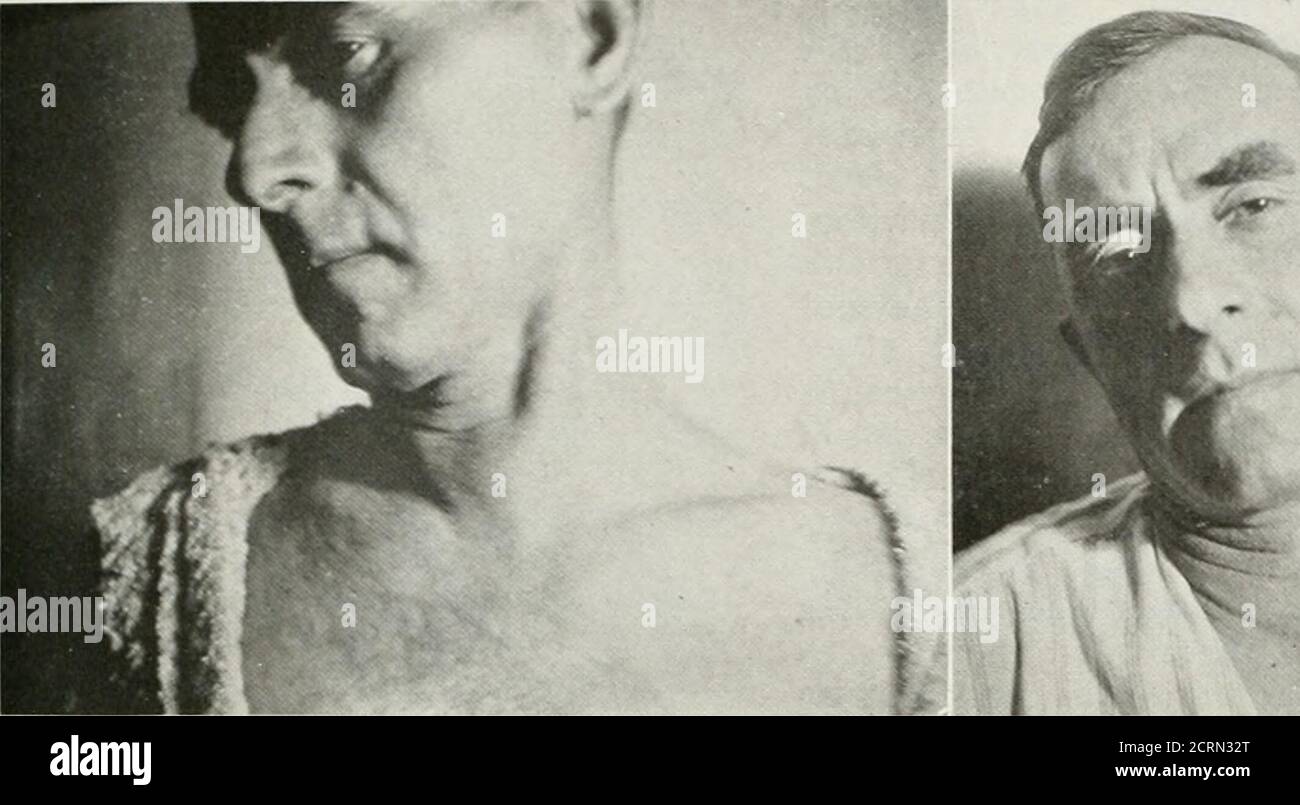 Epigastric region hi-res stock photography and images - Alamy