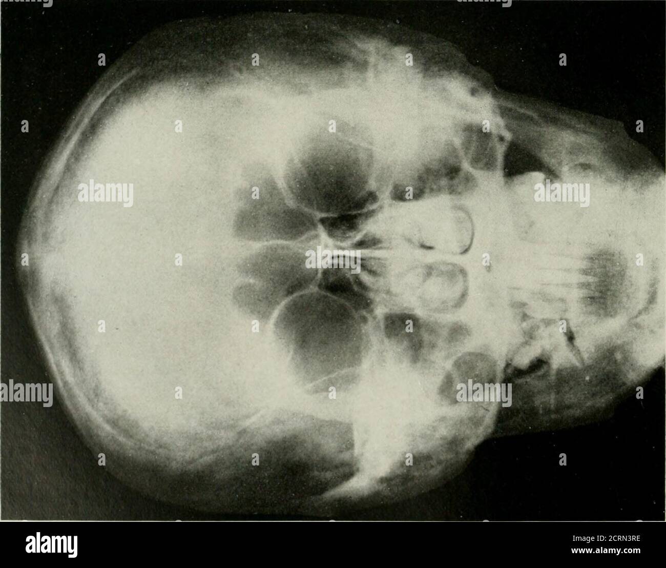 Seccotine hi-res stock photography and images - Alamy