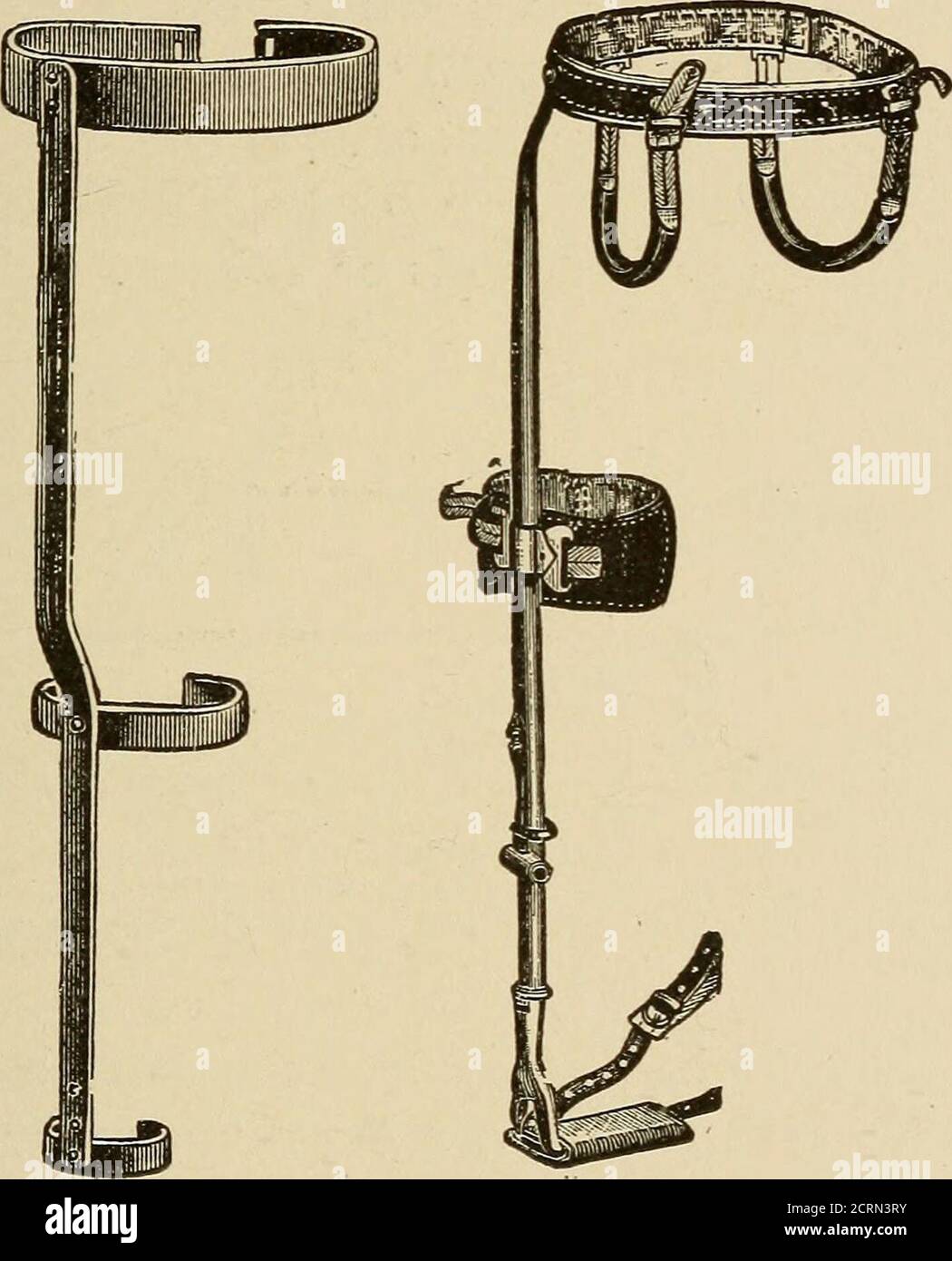 . Diseases of bones and joints . Fig. 35. Short plaster of Paris spicas ...