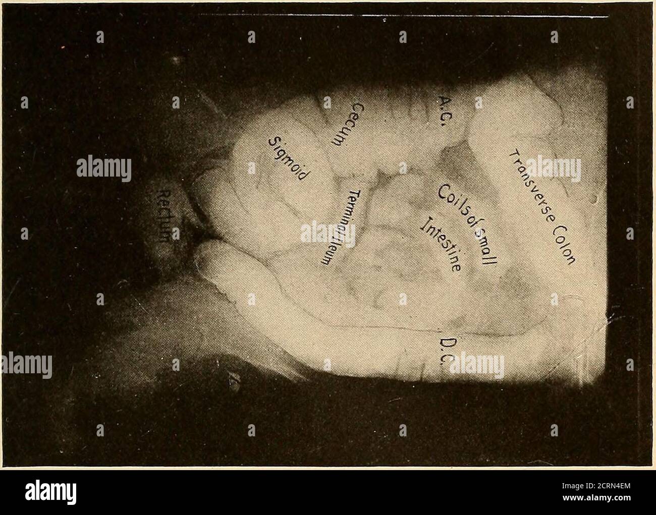 Movable obstruction hi-res stock photography and images - Alamy