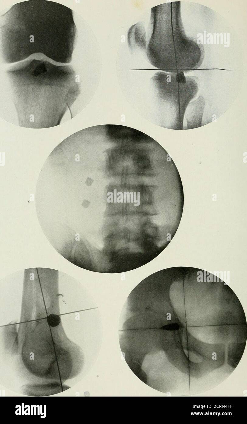 . Radiography and radio-therapeutics . PLATE Vlir.—Skui.l Inji-hies ...