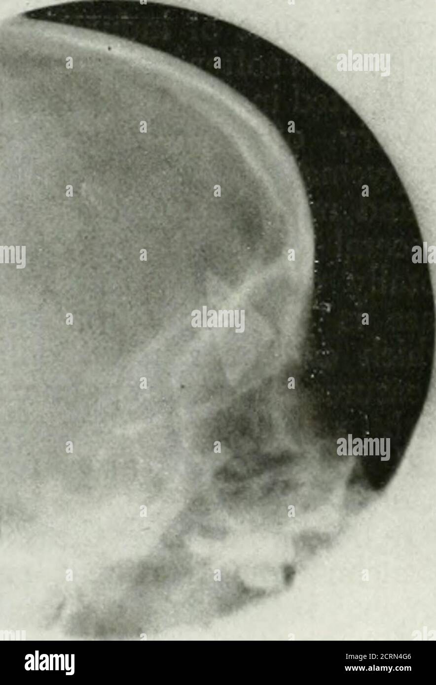 . The American journal of roentgenology, radium therapy and nuclear ...