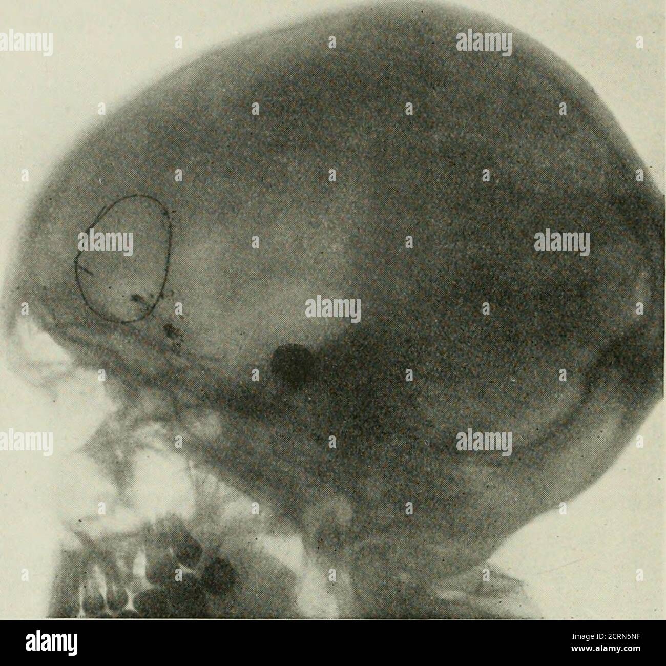 . Radiography and radio-therapeutics . 186 RADIOGRAPHY. Fig. 159 ...