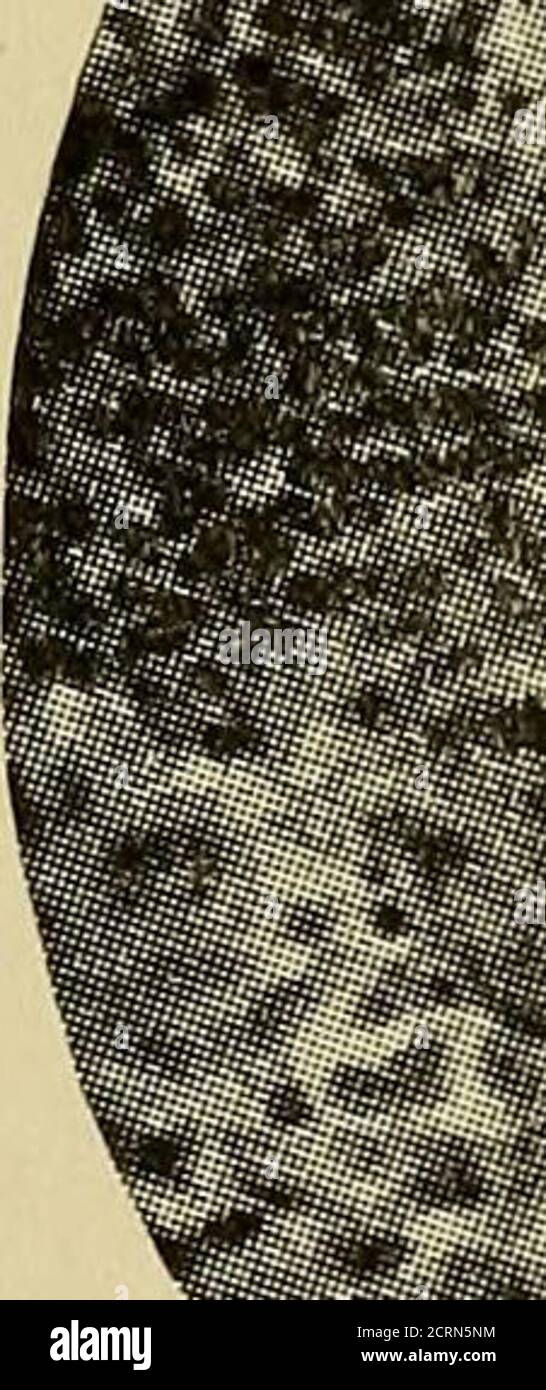 . Diseases of bones and joints . robable syphilitic arthritis of the ...