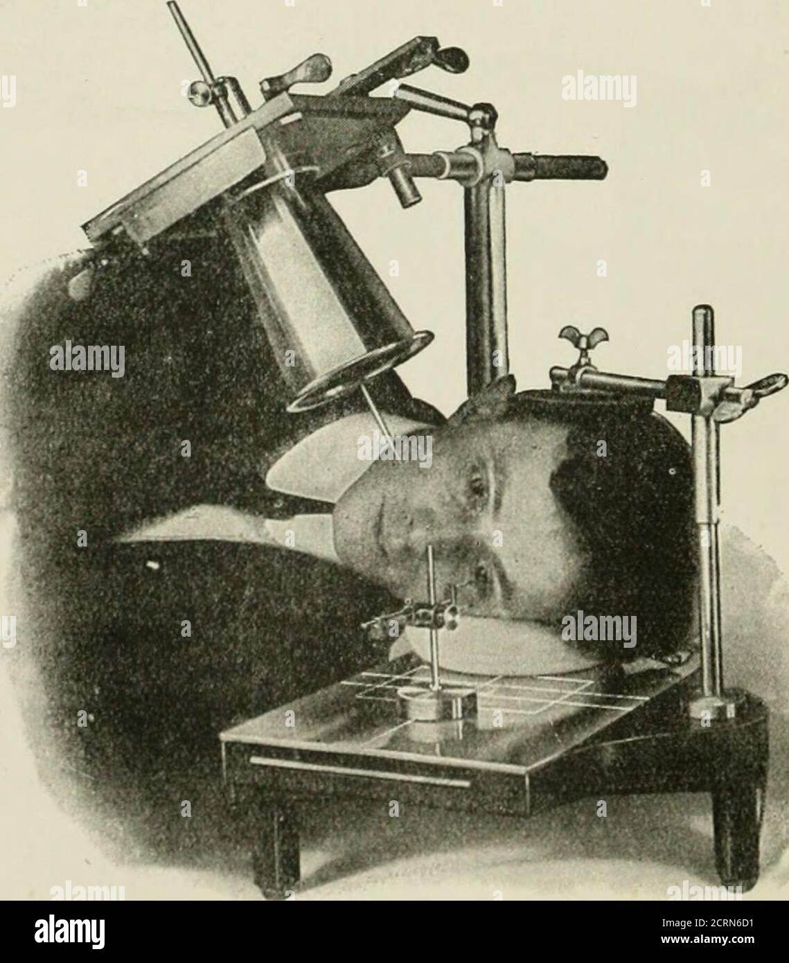 . Radiography and radio-therapeutics . Fig. 149.—Sweets eye localiser ...