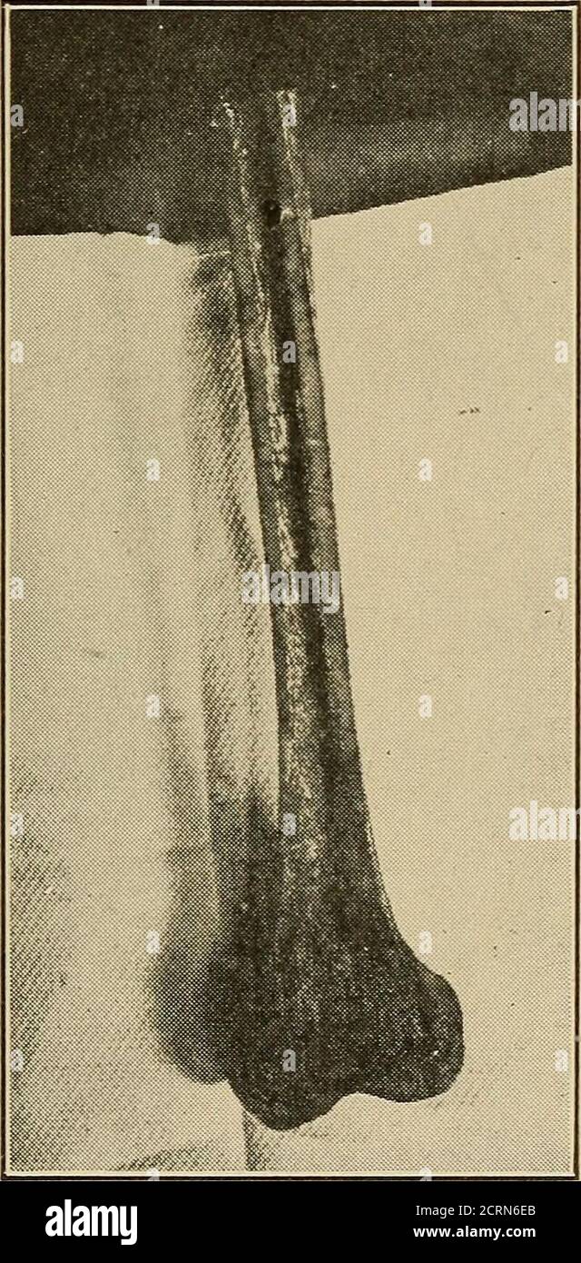 . Diseases of bones and joints . it linesalso the shafts of the long ...