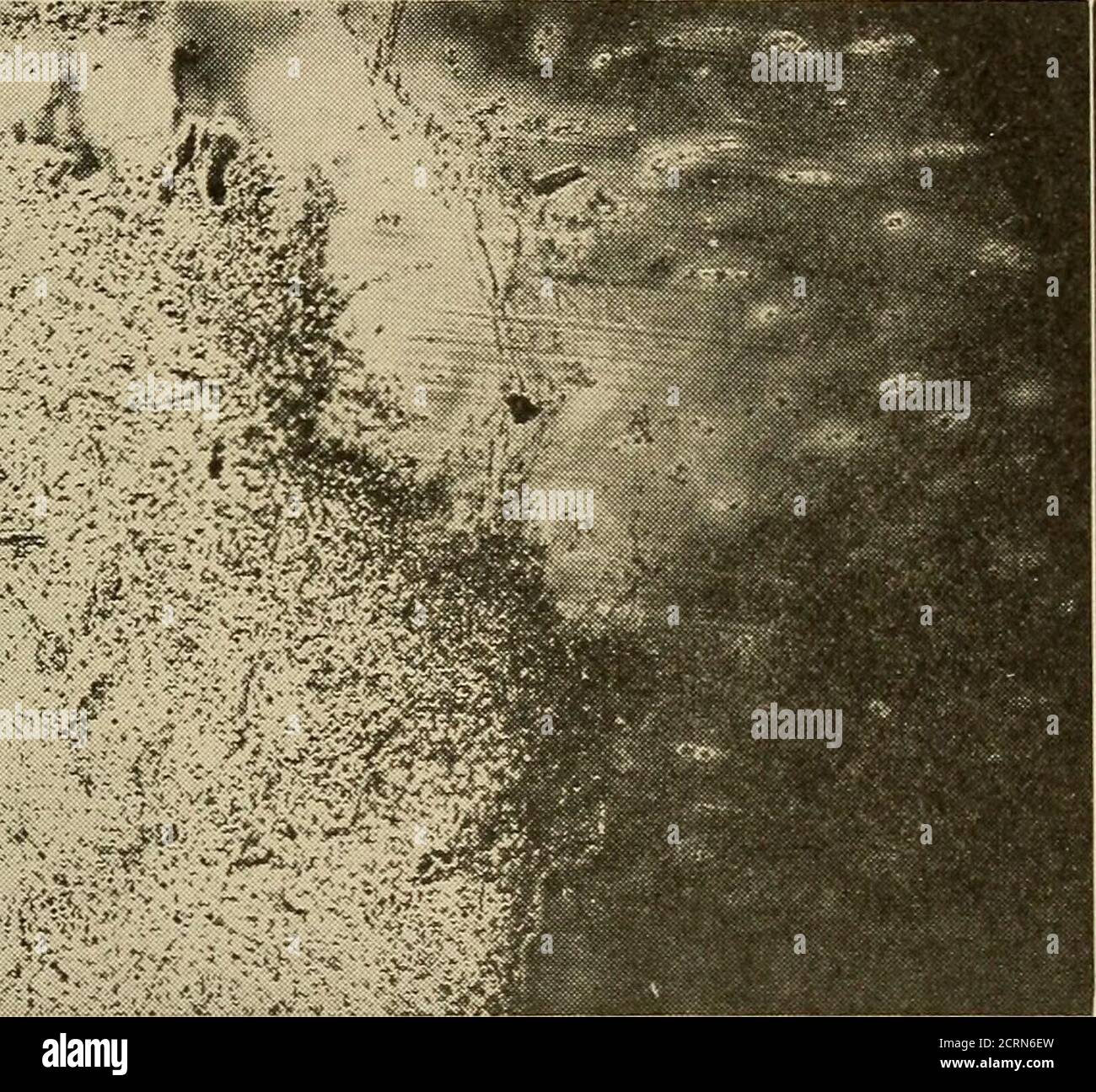 . Diseases of bones and joints . I :**i • , Fig. 5. Photomicrograph of ...