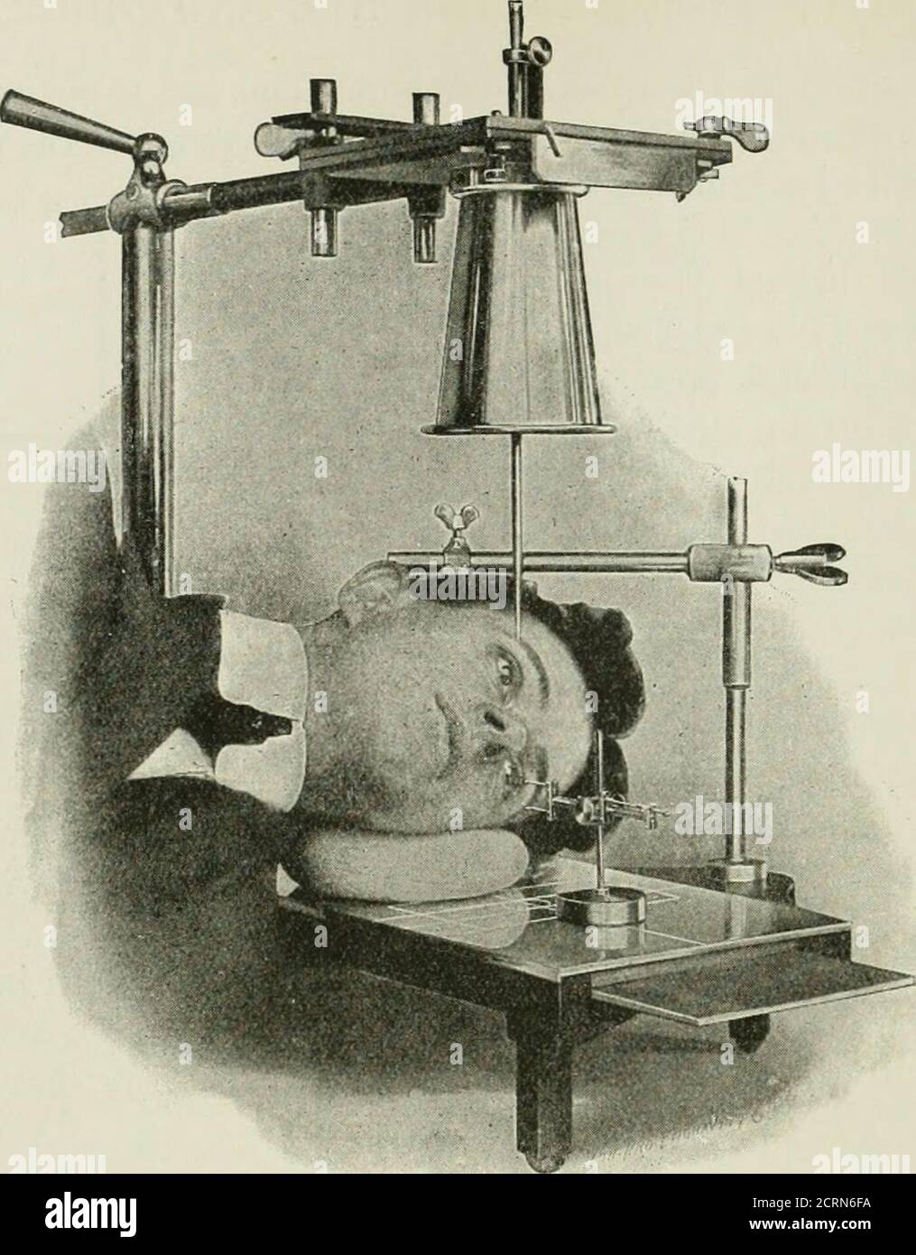 . Radiography and radio-therapeutics . Fig. 148,—Sweet localiser ...