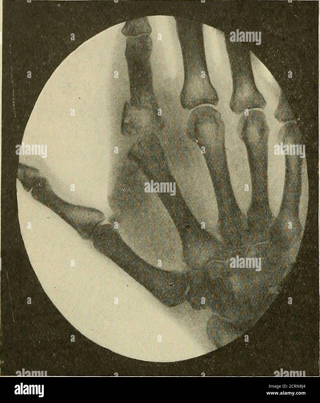 . Radiography and radio-therapeutics . accompanying degree of ...