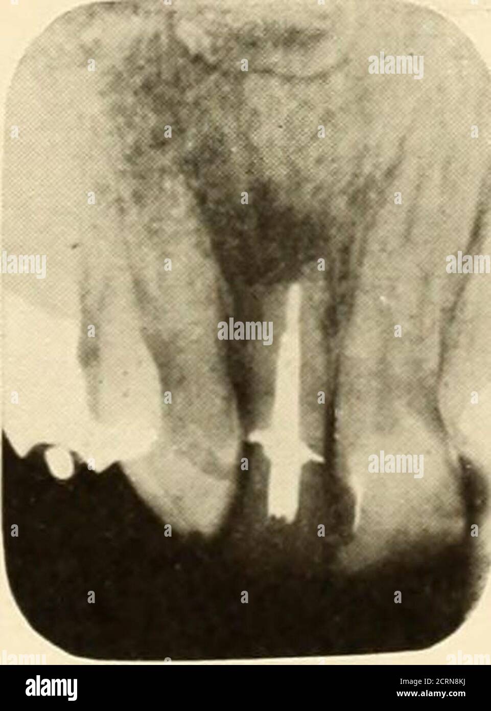 Oral Roentgenology : a Roentgen study of the anatomy and pathology of ...