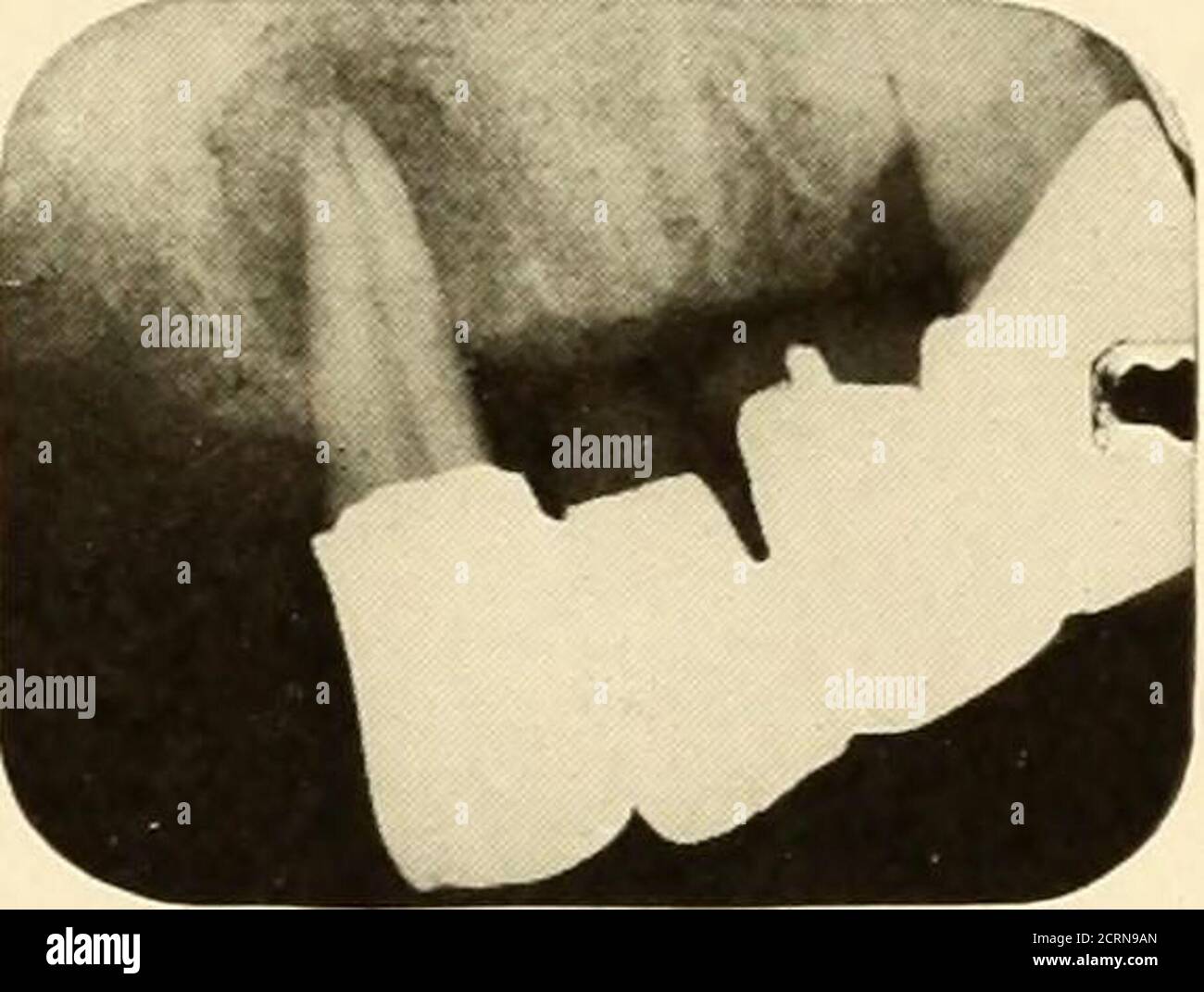 Oral Roentgenology : a Roentgen study of the anatomy and pathology of ...