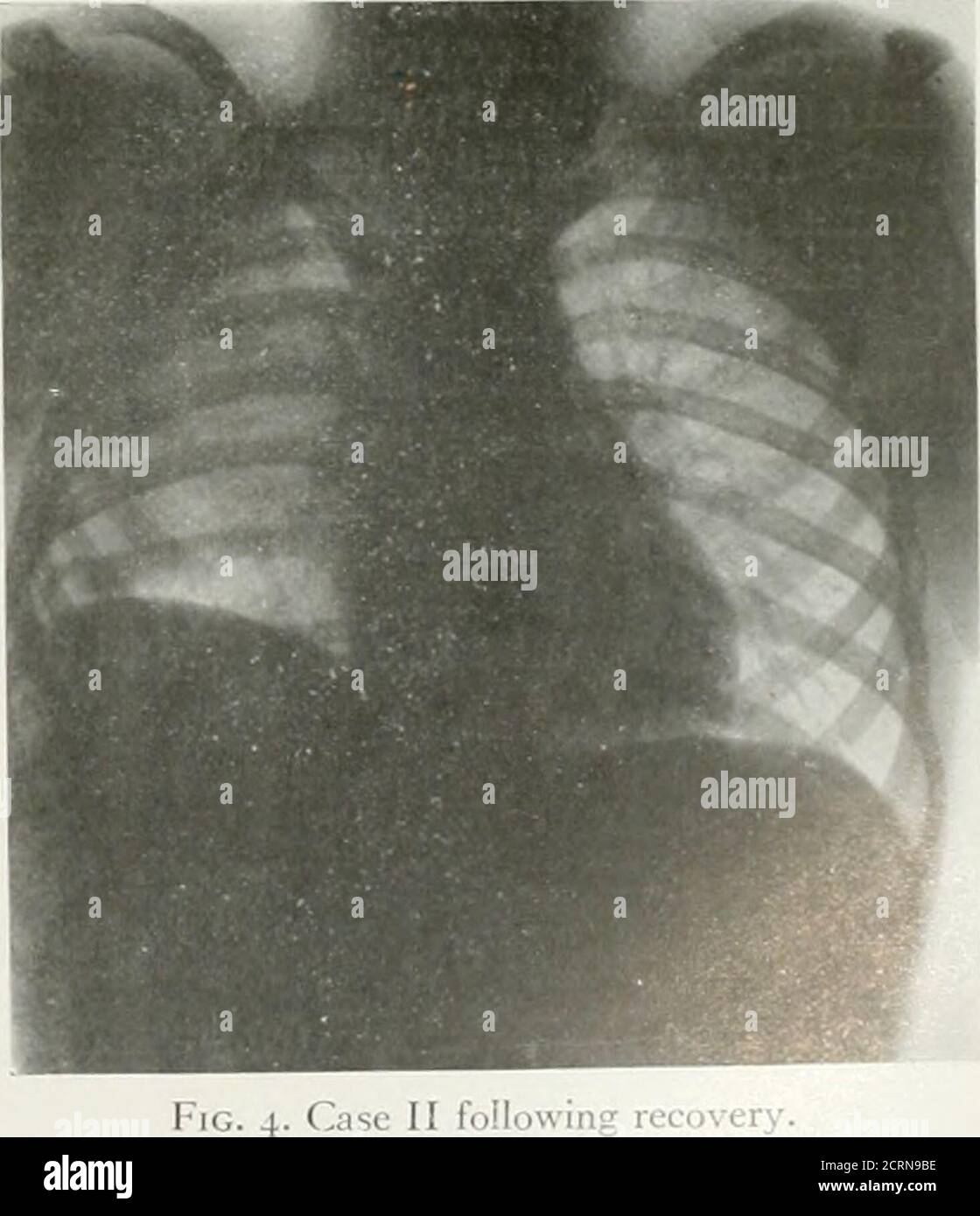 Sudden drainage hi-res stock photography and images - Alamy