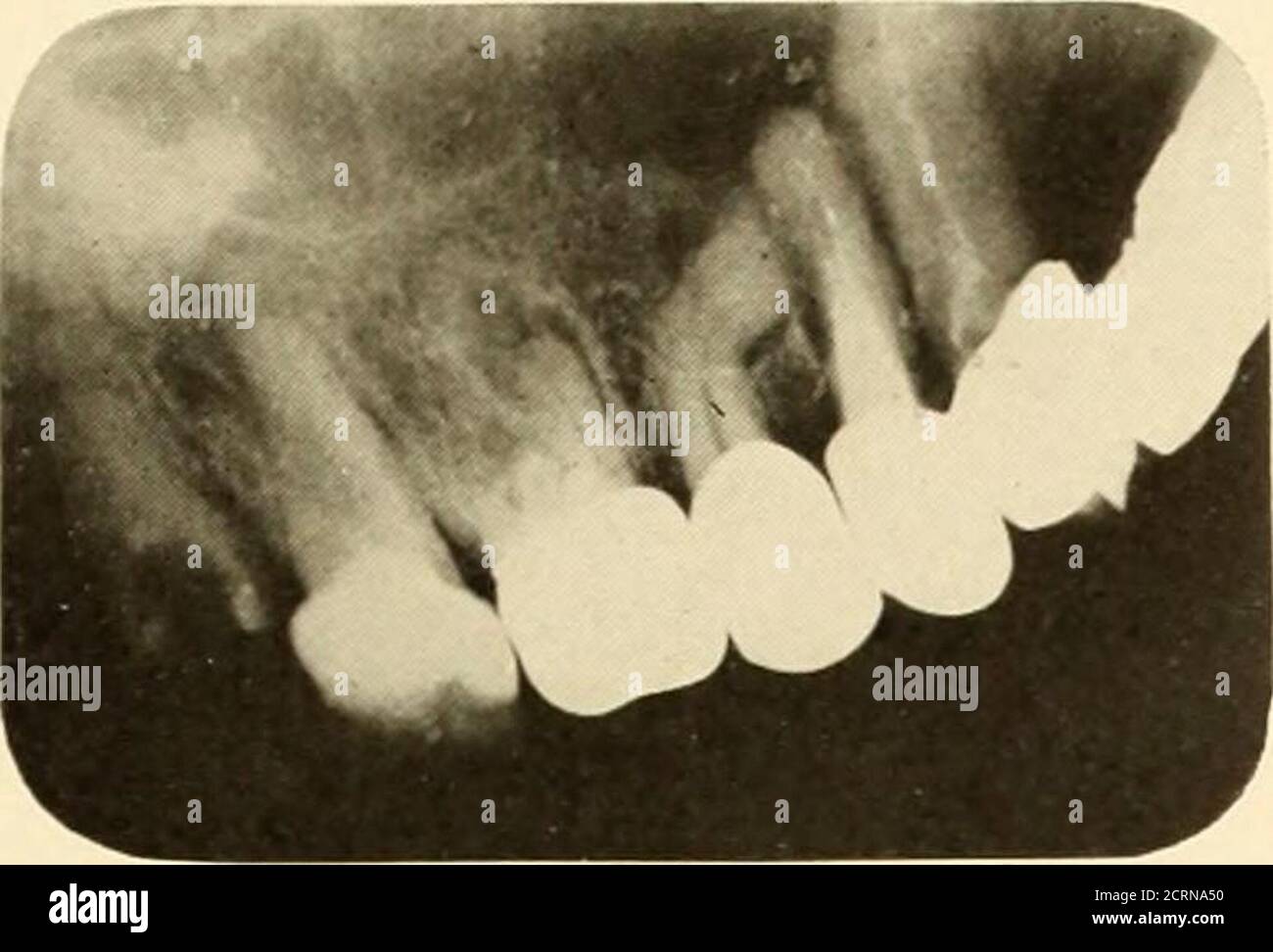 Radiolucent hi-res stock photography and images - Alamy