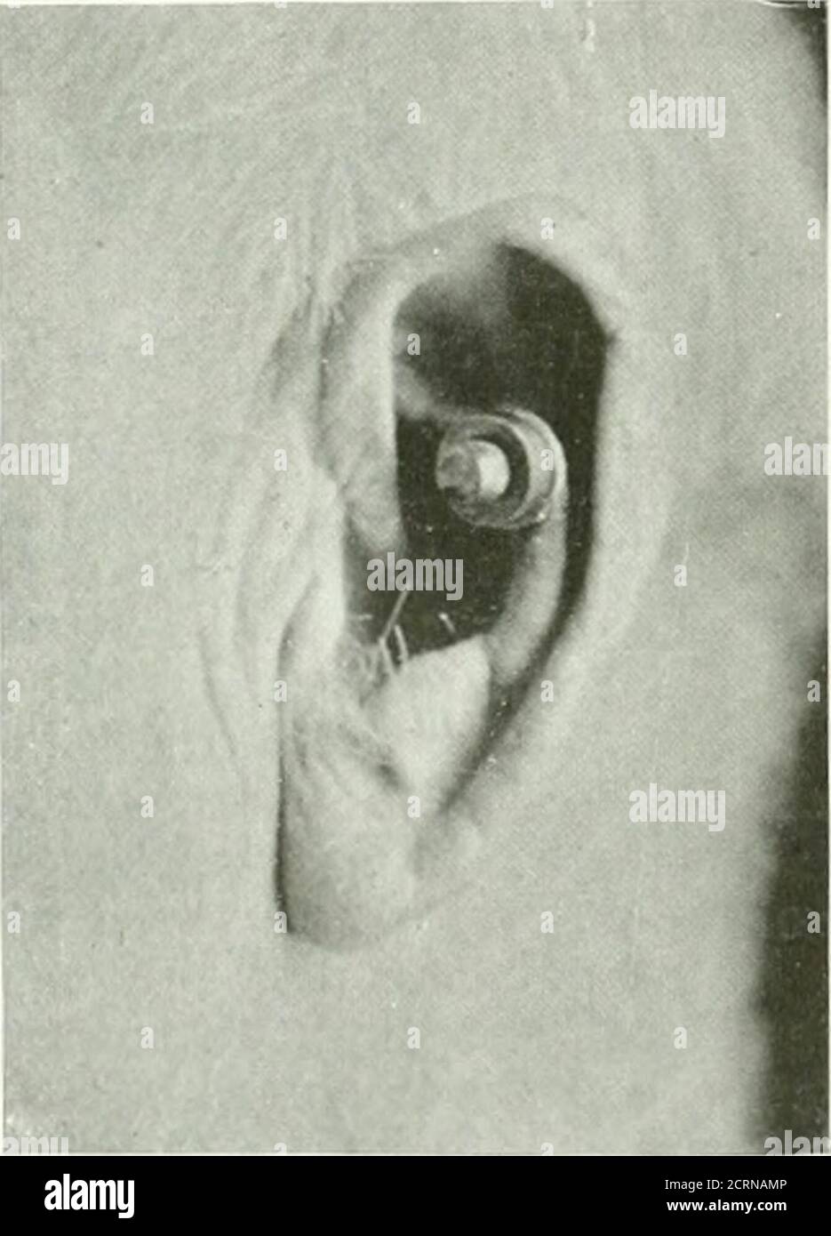Medicines That Use Radium