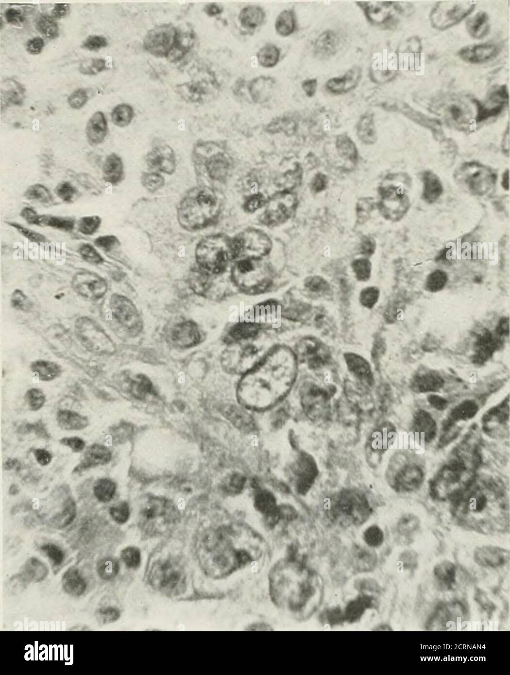 . The American journal of roentgenology, radium therapy and nuclear ...