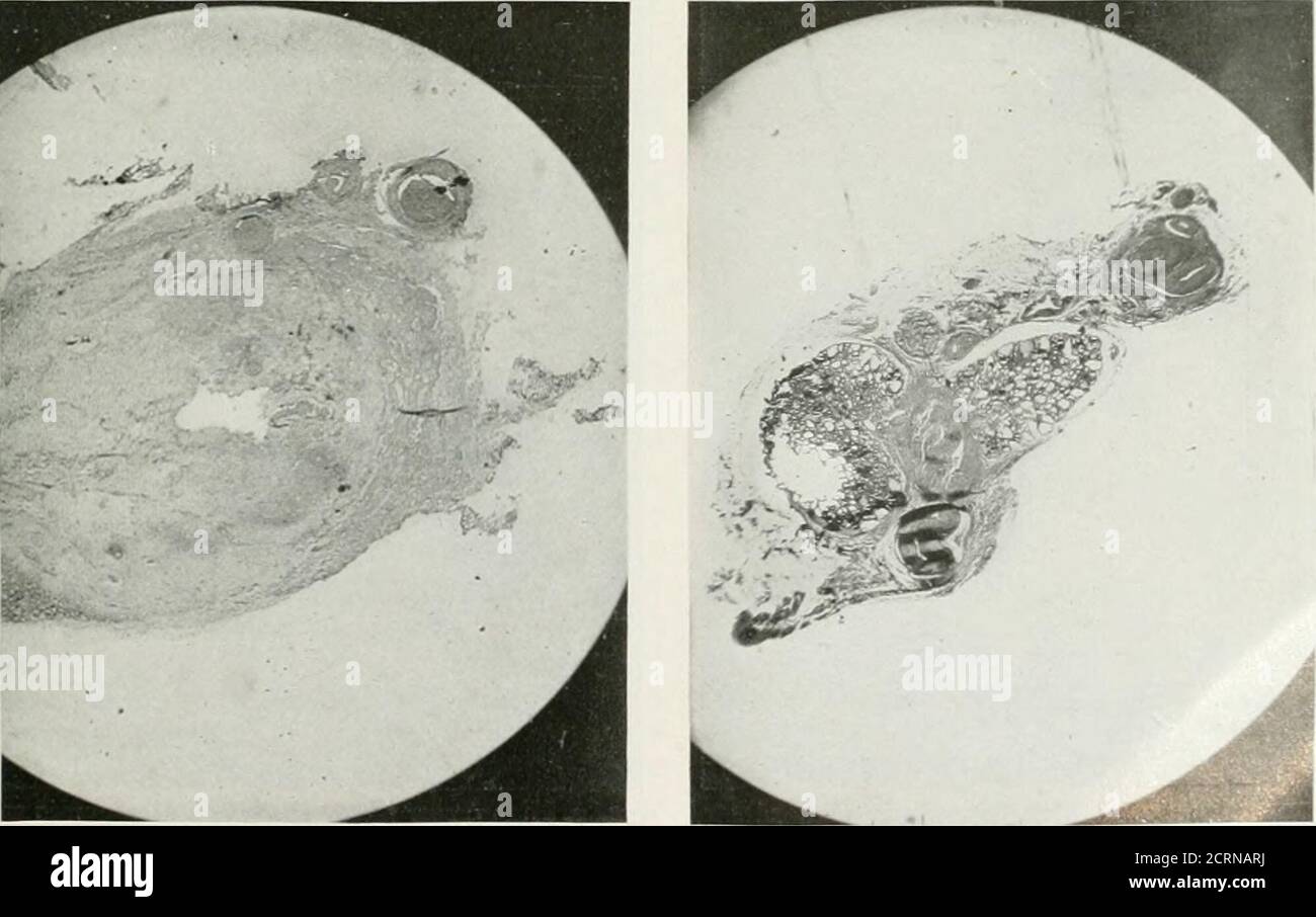 . The American journal of roentgenology, radium therapy and nuclear ...