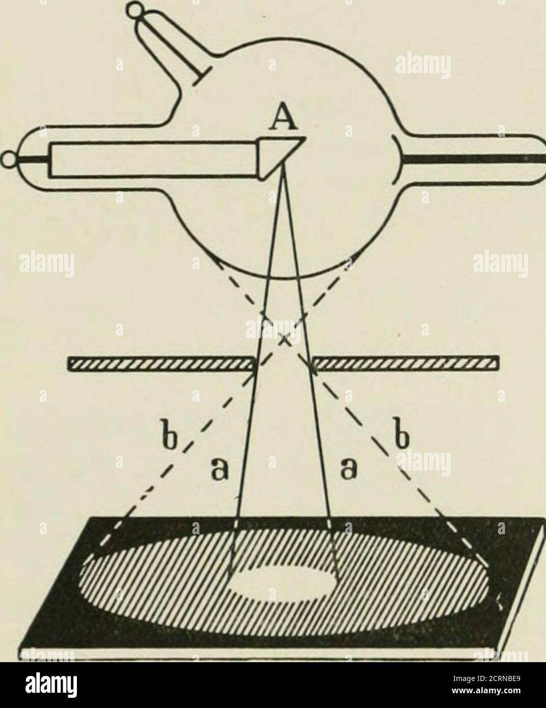 Projection radiography hi-res stock photography and images - Alamy