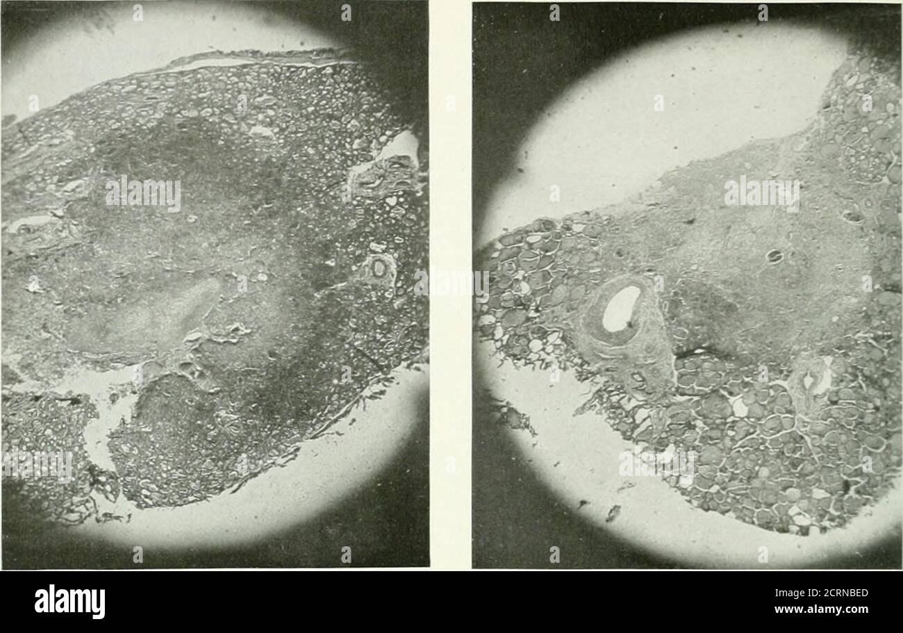 Thyroid gland dog hi-res stock photography and images - Alamy
