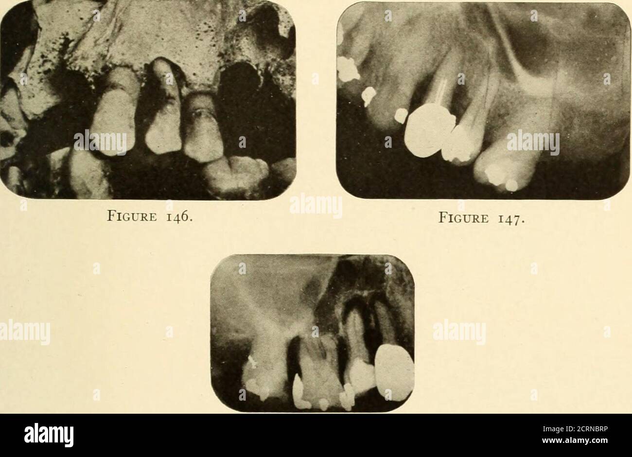 Oral Roentgenology : a Roentgen study of the anatomy and pathology of ...