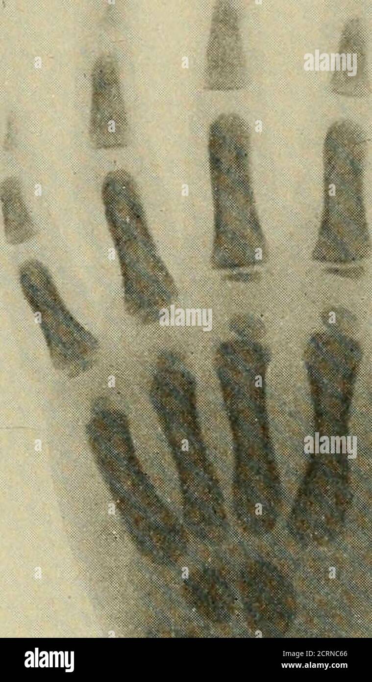 Radiography and radio-therapeutics