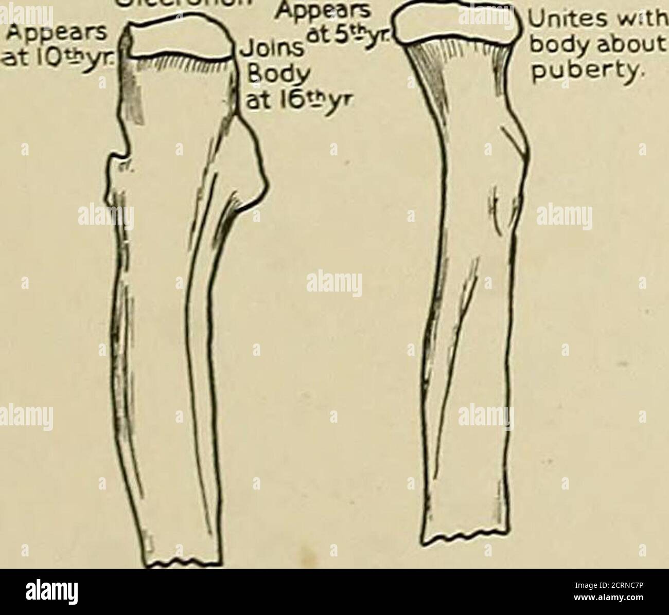 . Radiography and radio-therapeutics . -> 8 lateraldyle. 5 Capitalum ...