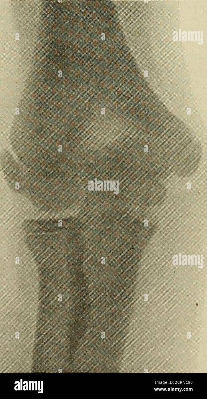 Anteroposterior view hi-res stock photography and images - Alamy