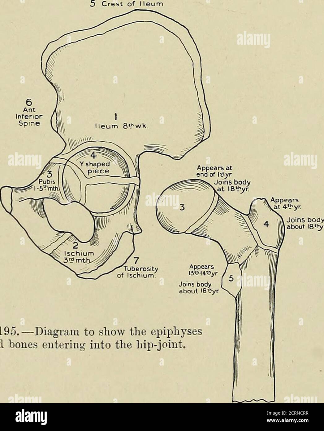 . Radiography and radio-therapeutics . Lines offracture EpiphysealliDe ...