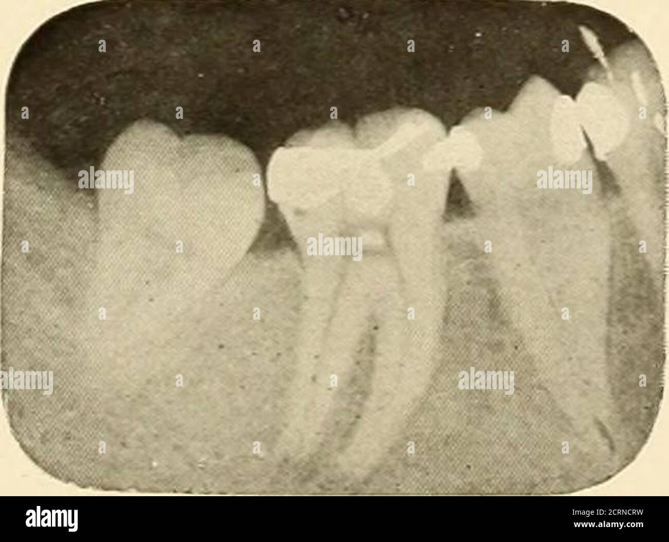 Oral Roentgenology : a Roentgen study of the anatomy and pathology of ...