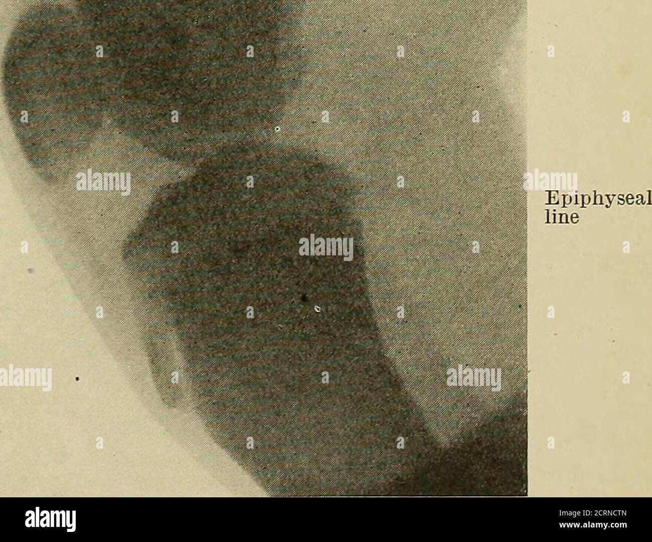 . Radiography and radio-therapeutics . Patella Anteroposterior. Lateral ...
