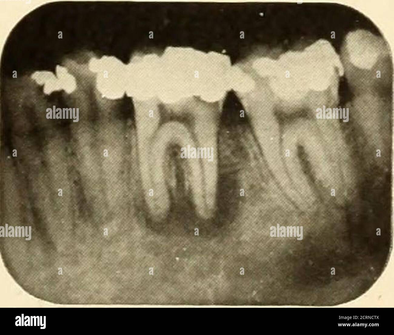 Oral Roentgenology : a Roentgen study of the anatomy and pathology of ...