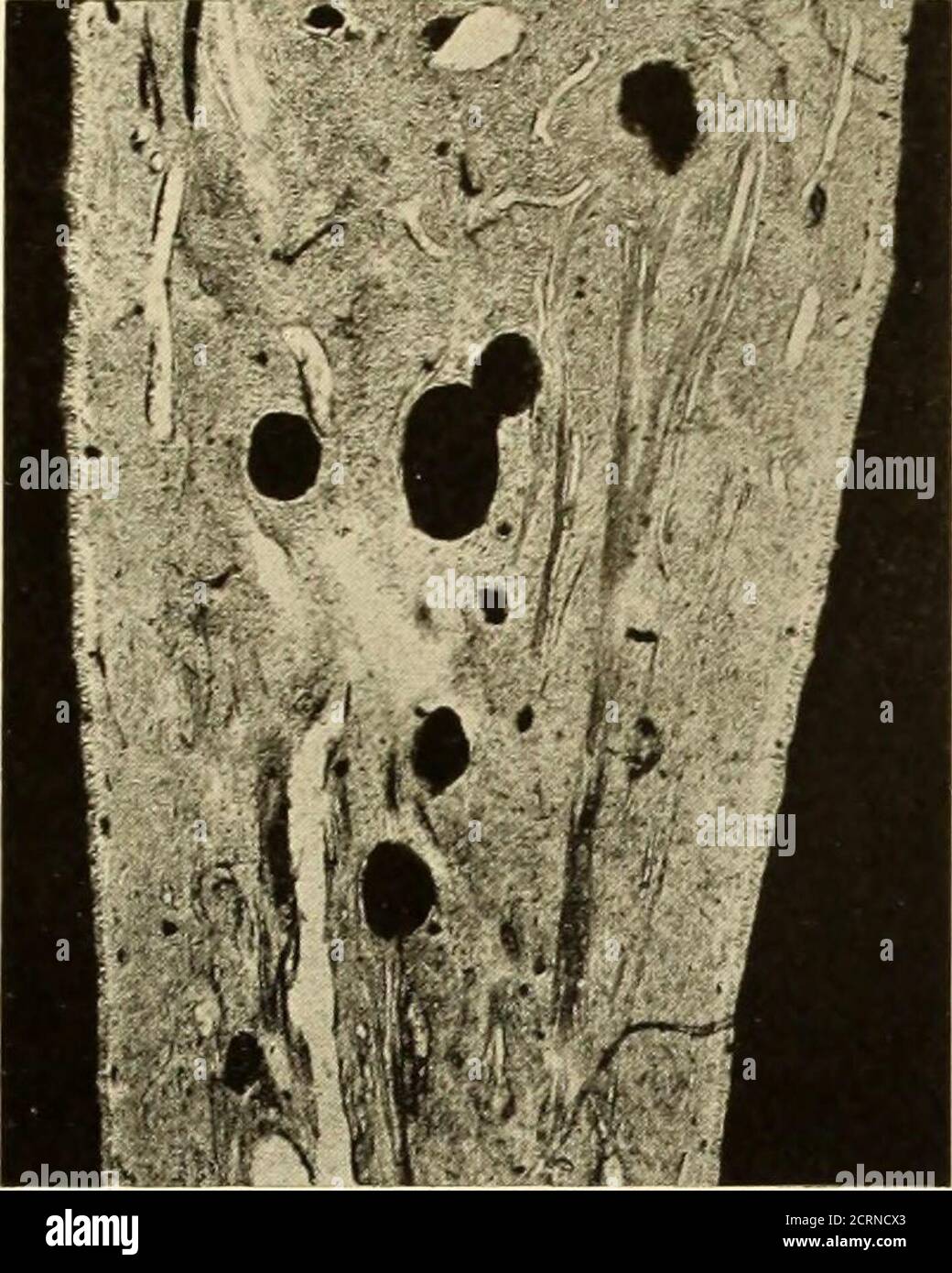 Oral Roentgenology : a Roentgen study of the anatomy and pathology of ...