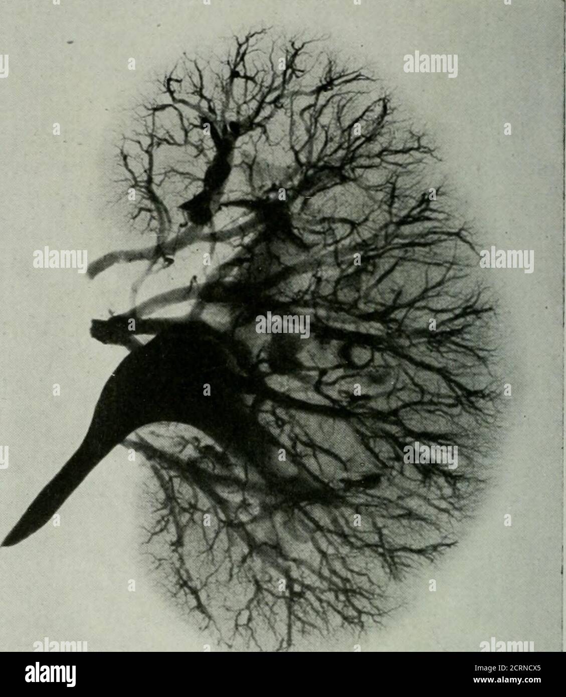 . The American journal of roentgenology, radium therapy and nuclear ...