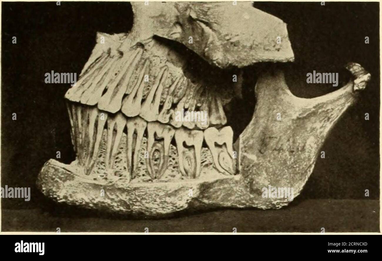 Oral Roentgenology : a Roentgen study of the anatomy and pathology of ...