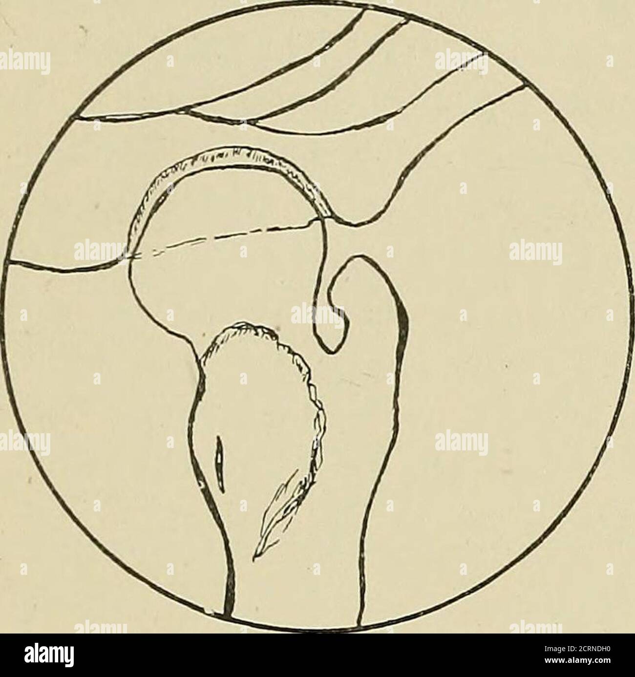 . Radiography and radio-therapeutics . y-five degrees, passing through ...