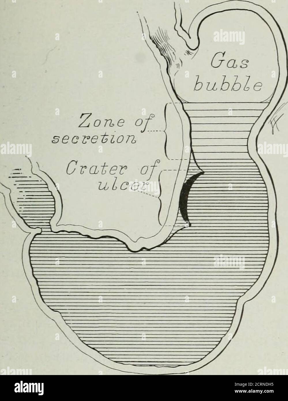 . The American journal of roentgenology, radium therapy and nuclear ...