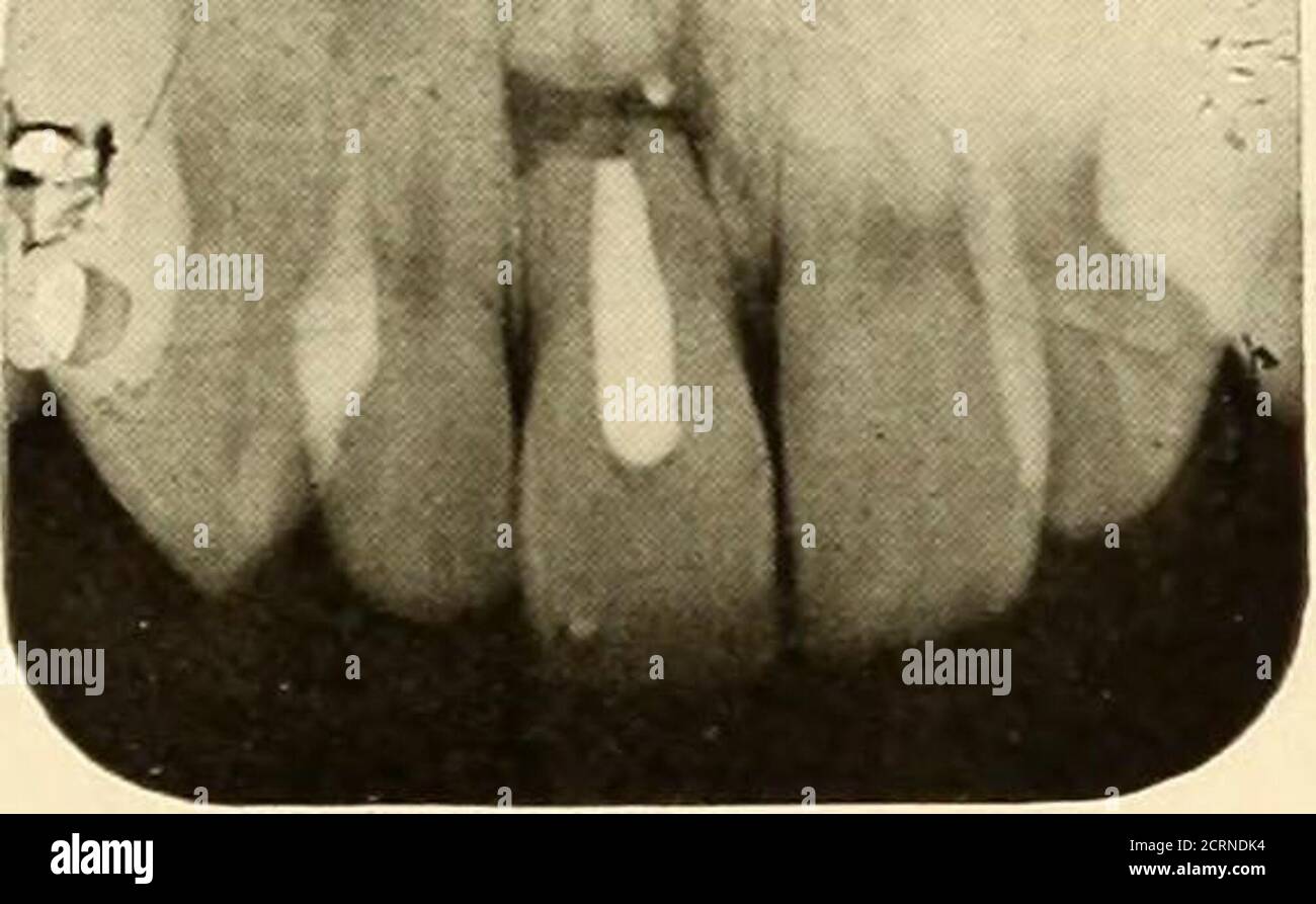 W c roentgen hi-res stock photography and images - Alamy